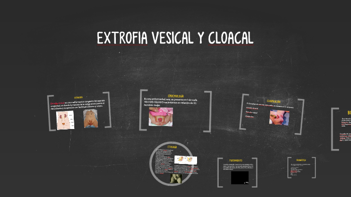 EXTROFIA VESICAL by Sofia De la torre on Prezi