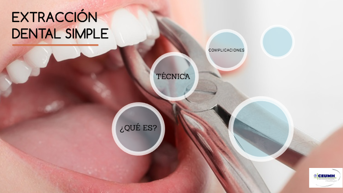 Extracción dental simple by Meritxell Mariel on Prezi