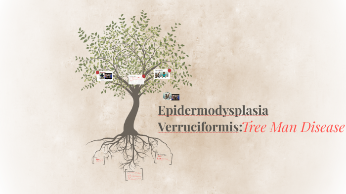 Tree Man Disease By Kendra Burrow On Prezi
