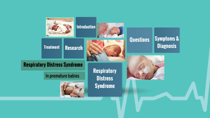 Respiratory Distress Syndrome Premature Babies