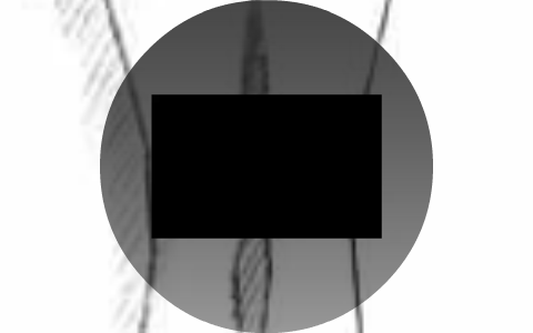 Fibromialgía by Sergio Antonio Álvarez Morquecho