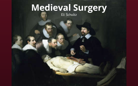 Medieval Surgery by Eli Schultz on Prezi