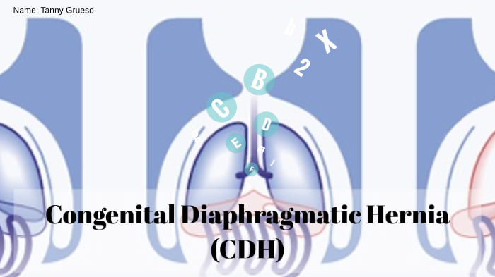 Congenital Diaphragmatic Hernia (CDH) by Myrka Cedillo on Prezi