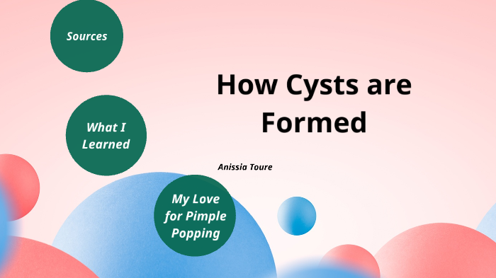 How are Cyst Formed by Anissia Toure on Prezi