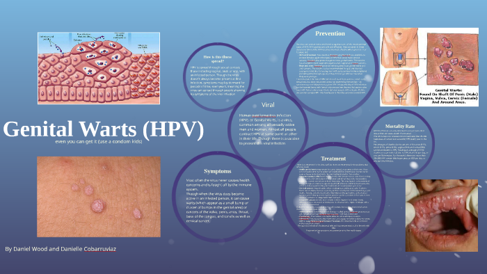 Genital Warts (HPV) by Greatest Ever on Prezi