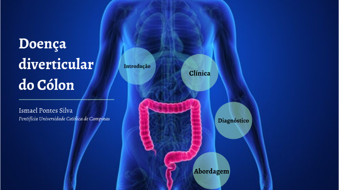 Doença diverticular do cólon by Ismael Silva on Prezi