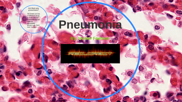 What is pneumonia? by Hunter Foehner on Prezi