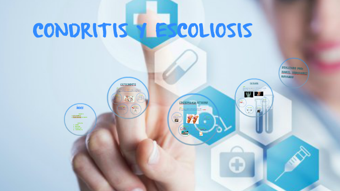 CONDRITIS Y ESCOLIOSIS by Daniel Hernández Navarro on Prezi