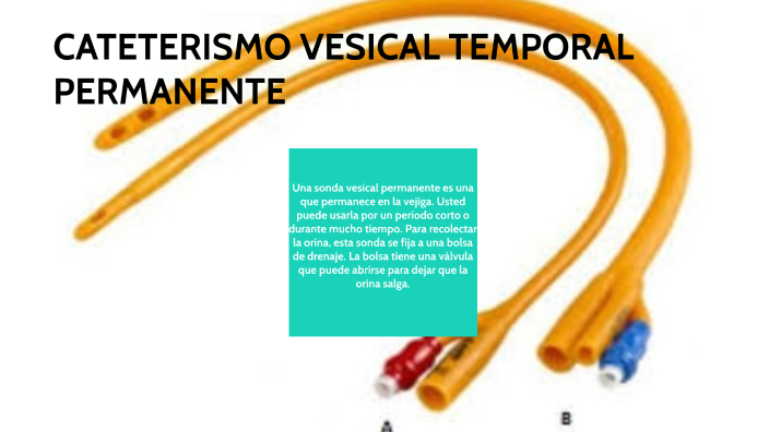 CATETERISMO VESICAL TEMPORAL PERMANENTE. by julieth avila on Prezi