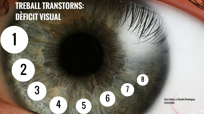 DEFICIT VISUAL by Claudia Dominguez on Prezi