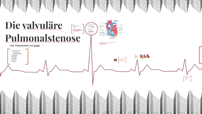 Pulmonalstenose Leitlinie : Leitlinie: Valvuläre Pulmonalstenose ...