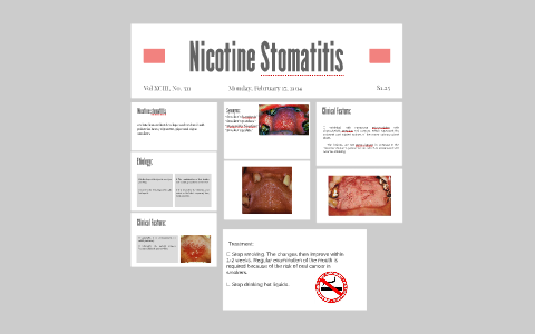 Nicotine Stomatitis by GianCarlo Eduardo