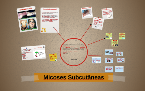 Micoses Subcutâneas by Mirian Barboza on Prezi