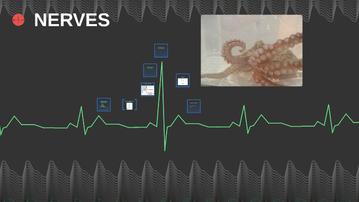 NERVES by Peter Gulian on Prezi