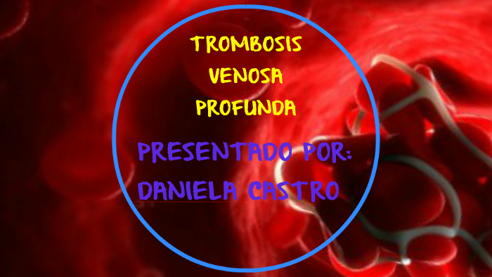 TROMBOSIS VENOSA PROFUNDA by Daniela Castro