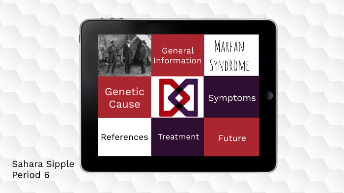 Marfan Syndrome by Sahara Sipple on Prezi