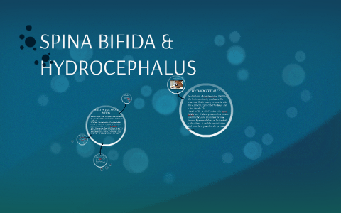 SPINA BIFIDA & HYDROCEPHALUS by Angel Charles on Prezi