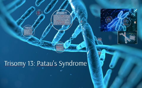 A.P. Bio: Trisomy 13 by Jordan Collins on Prezi