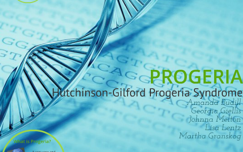 PROGERIA by Lisa Lentz on Prezi