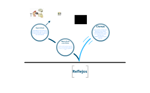 Hiperreflexia, hiporreflexia, clonus by Adriana Campos on Prezi