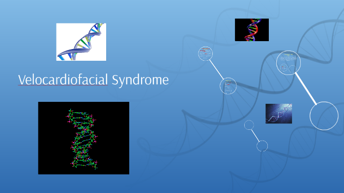 Velocardiofacial Syndrome by Max Trimm on Prezi