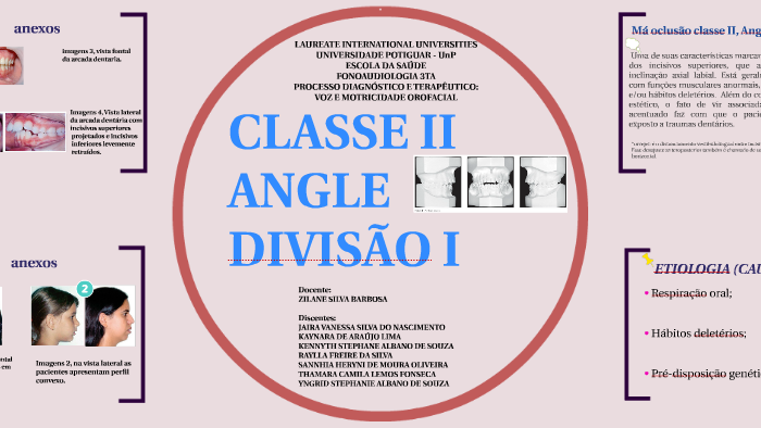 CLASSE II ANGLE DIVISÃO I by Kaynara Lima on Prezi