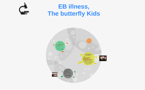 EB illness by Toroczkai Dóra on Prezi