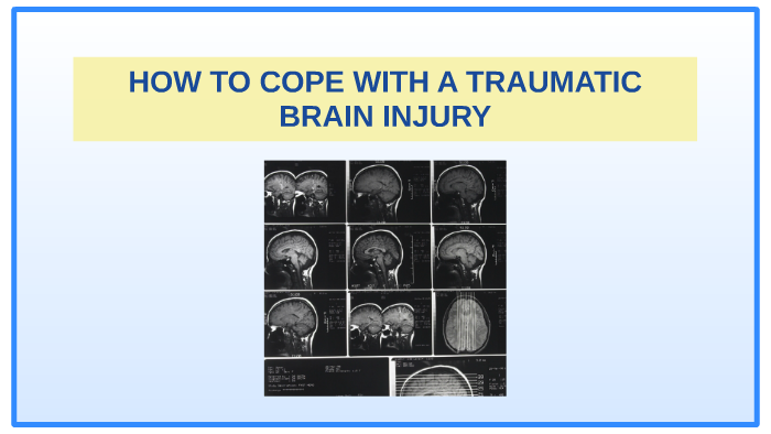 How to cope with a traumatic brain injury by Andrew Gurdak