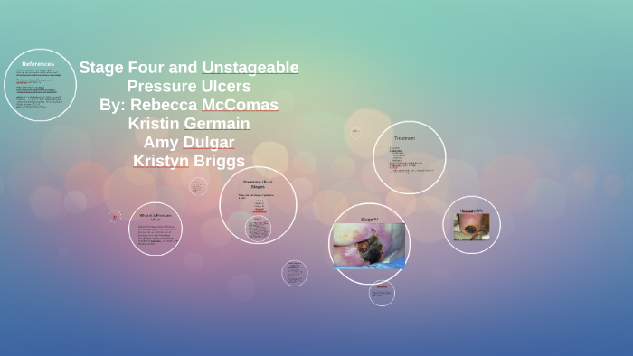 Stage Four and Unstageable Pressure Ulcers by rebecca Lane on Prezi