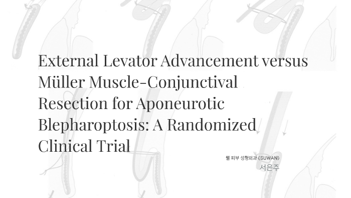 External Levator Advancement versus Müller Muscle-Conjunctiv by Hye Mi ...