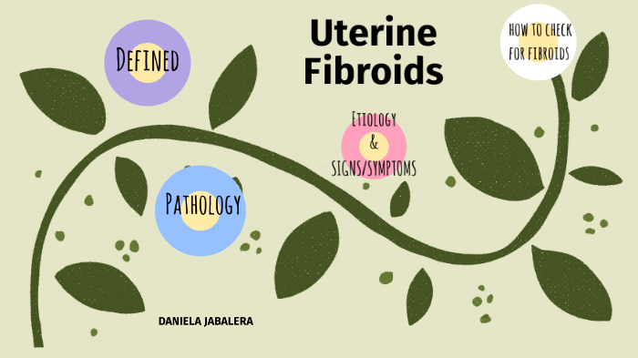 Pathology: Uterine Fibroid by Daniela Jabalera on Prezi