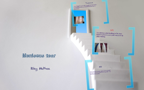 Meniscus tear by Riley McPhee on Prezi