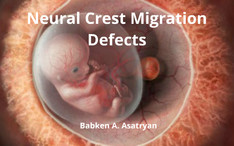 Development of the fetal Nervous System Neural Crest Migration Defects ...