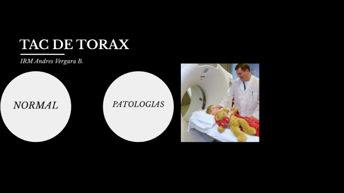 TAC TORAX NORMAL Y PATOLOGIO by Andres Bryan Vergara Bohorquez on Prezi