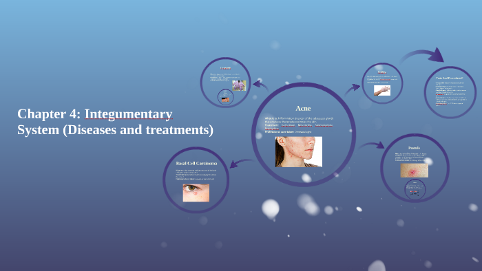Chapter 4: Integumentary System (Diseases and treatments) by peighton ...