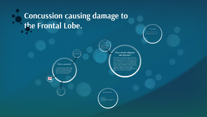Concussion causing damage to the Frontal Lobe. by Erica Sinclair on Prezi
