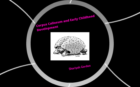 The Corpus Callosum and Early Childhood Development by Shariyah Gordon ...