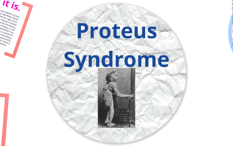 Proteus syndrome by Melissa S. on Prezi