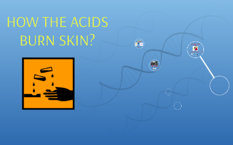 HOW THE ACIDS BURN SKIN? by cindy liliana peña gutierrez on Prezi