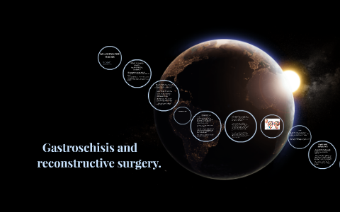 TRAUMA PLASTIC RECONSTRUCTIVE SURGERY by on Prezi