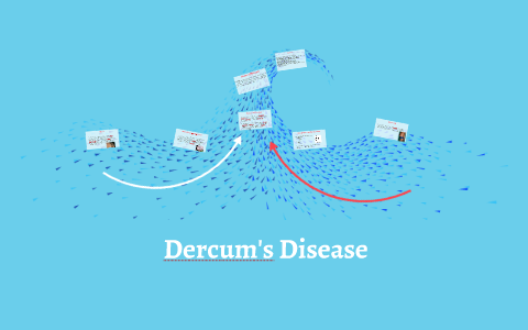 Dercum's Disease by Bailey Tyler on Prezi