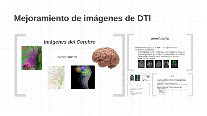 Mejoramiento de imágenes de DTI by Pablo Alexander Reyes on Prezi