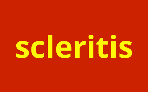 scleritis by kalista howard