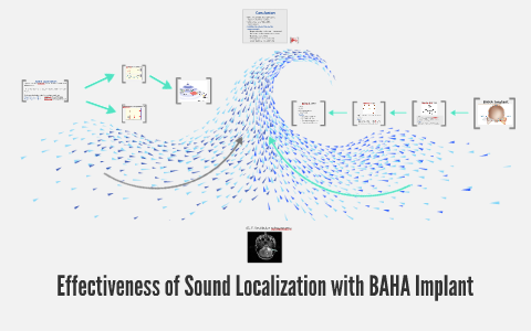 Unilateral Sensorineural Hearing Loss & BAHA Implant by Ann Qiu on Prezi