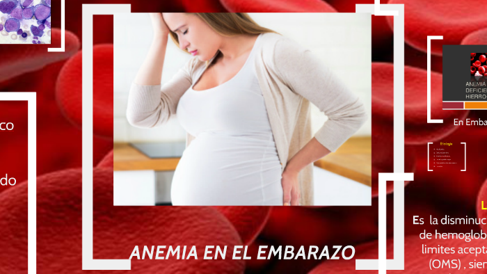 ANEMIA EN EL EMBARAZO by Anyeli Guerra on Prezi