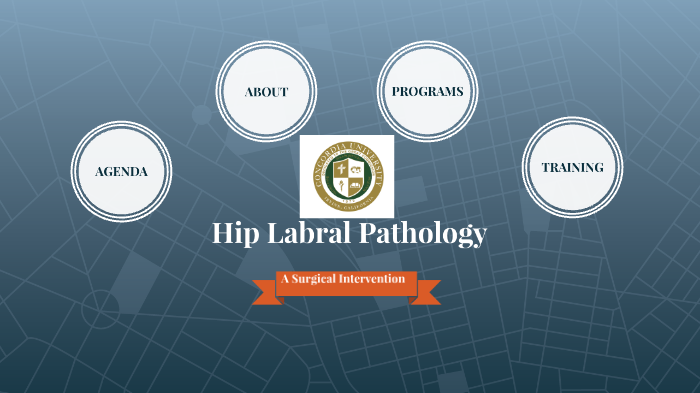 Hip Labral Pathology - A Surgical Intervention by Cliff Pawley on Prezi