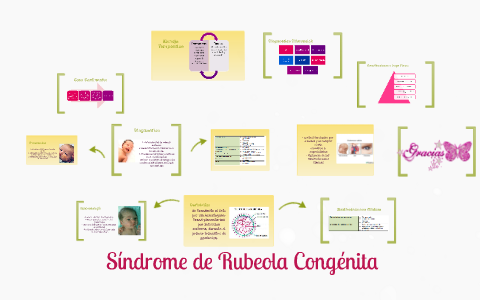 Sindrome de Rubeola Congenita by Shirley Aviles on Prezi