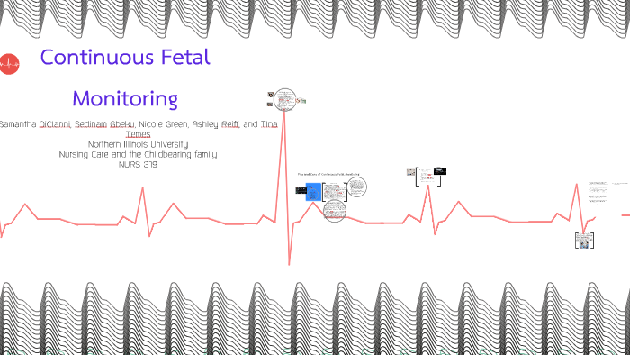 Continuous Fetal Monitoring by Samantha Dicianni on Prezi