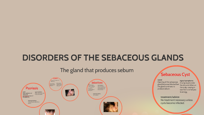 SEBACEOUS GLANDS CONDITIONS by Maxine Thomas