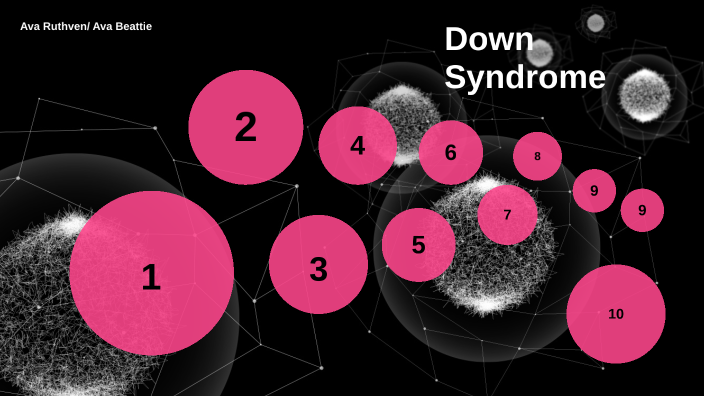 Down Syndrome by Ava Ruthven on Prezi